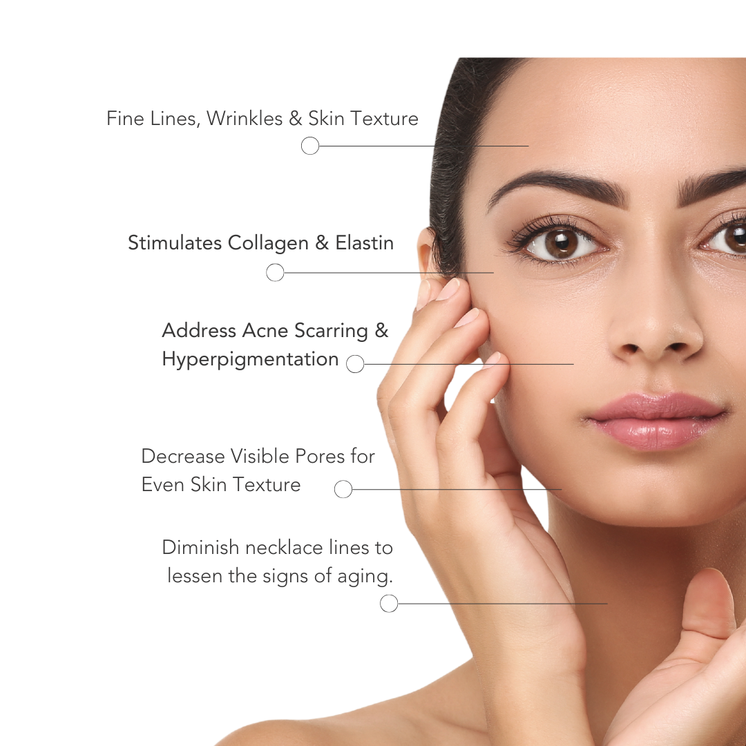 Rejuvenate Your Skin Naturally Rf Microneedlings Non Surgical Anti A